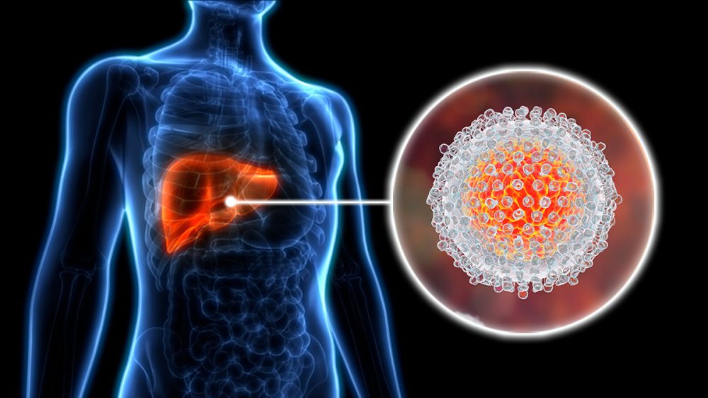 Hepatitis C - Diagnosis, and Management of This Viral Infection